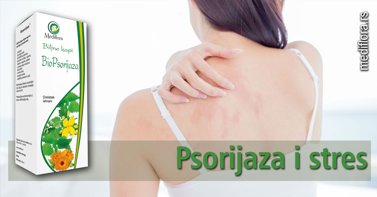 Psorijaza i stres - Mediflora