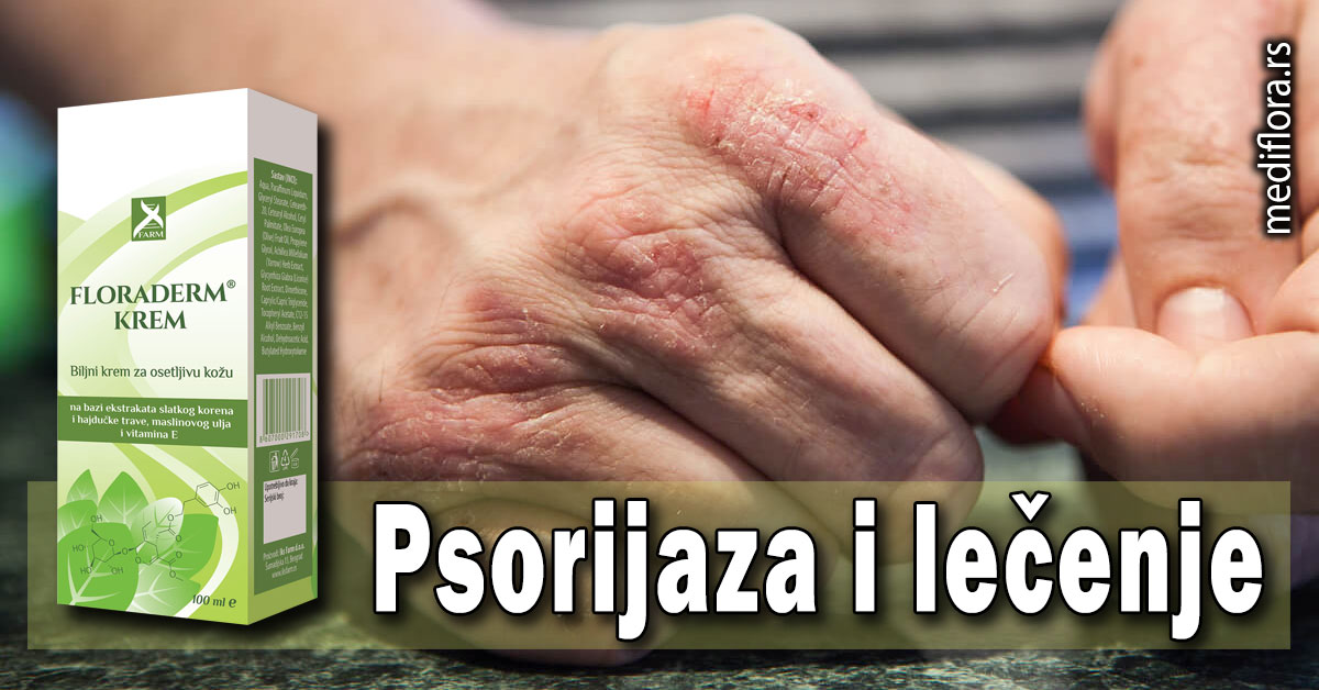 Psorijaza i lečenje - Mediflora