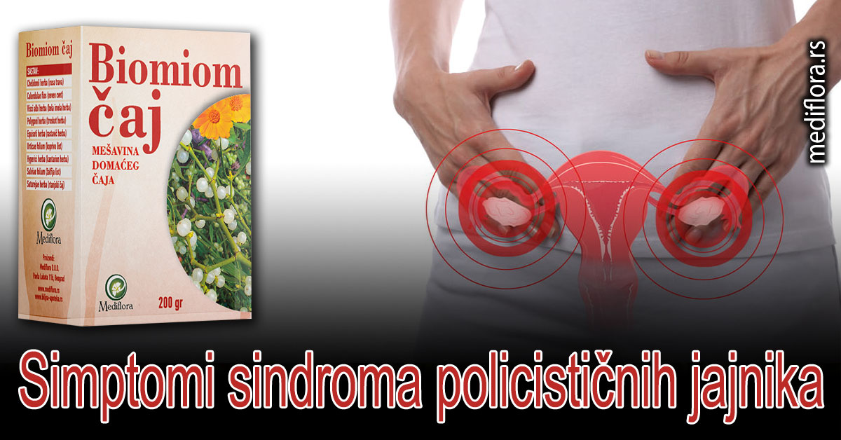 Simptomi sindroma policističnih jajnika - Mediflora