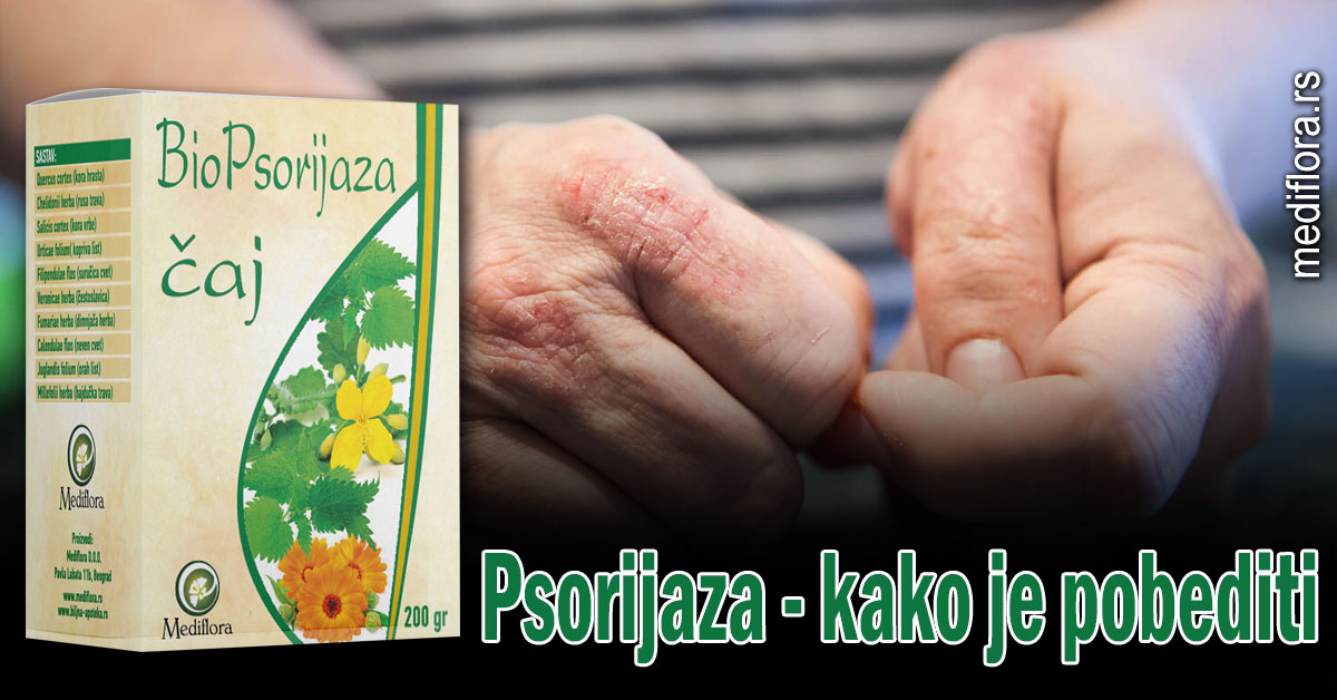 Psorijaza - kako je pobediti - Mediflora