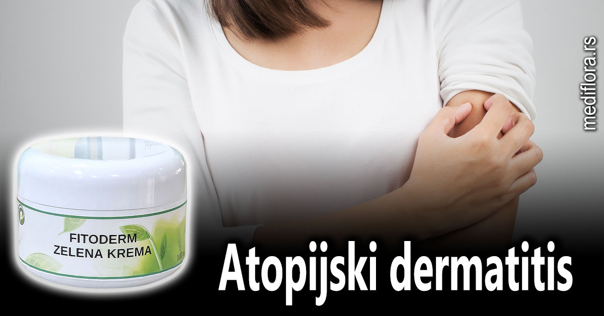 Atopijski dermatitis - Mediflora