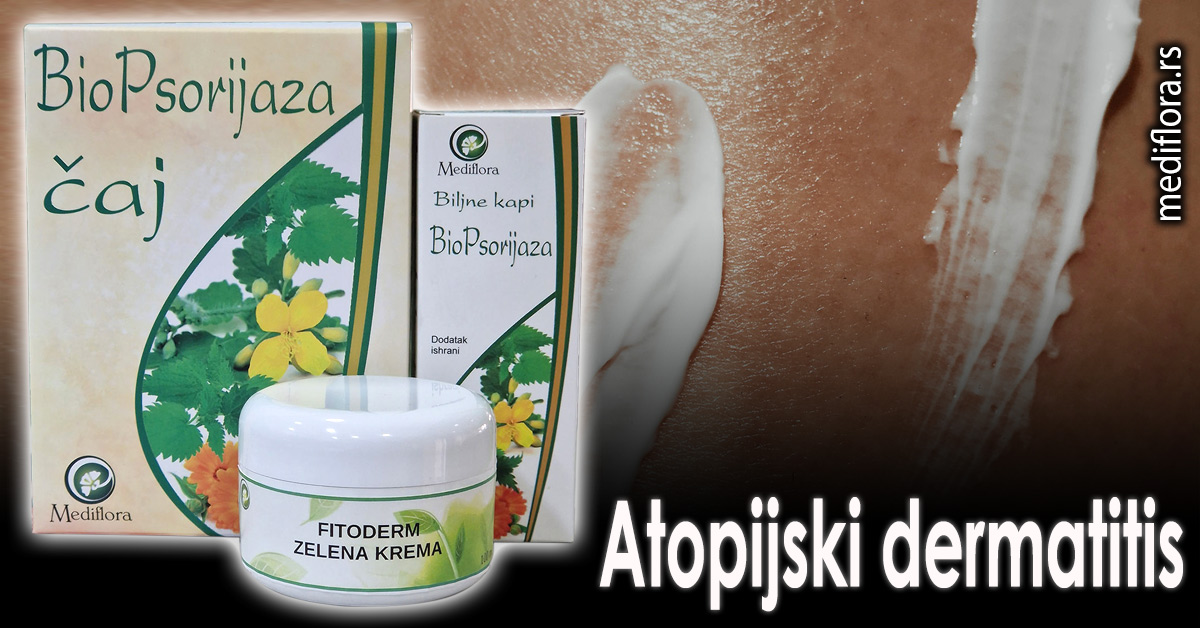 Atopijski dermatitis – Uzroci, simptomi i prirodno lečenje - Mediflora