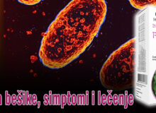 Upala bešike (cistitis) - uzroci, simptomi i lečenje - Mediflora